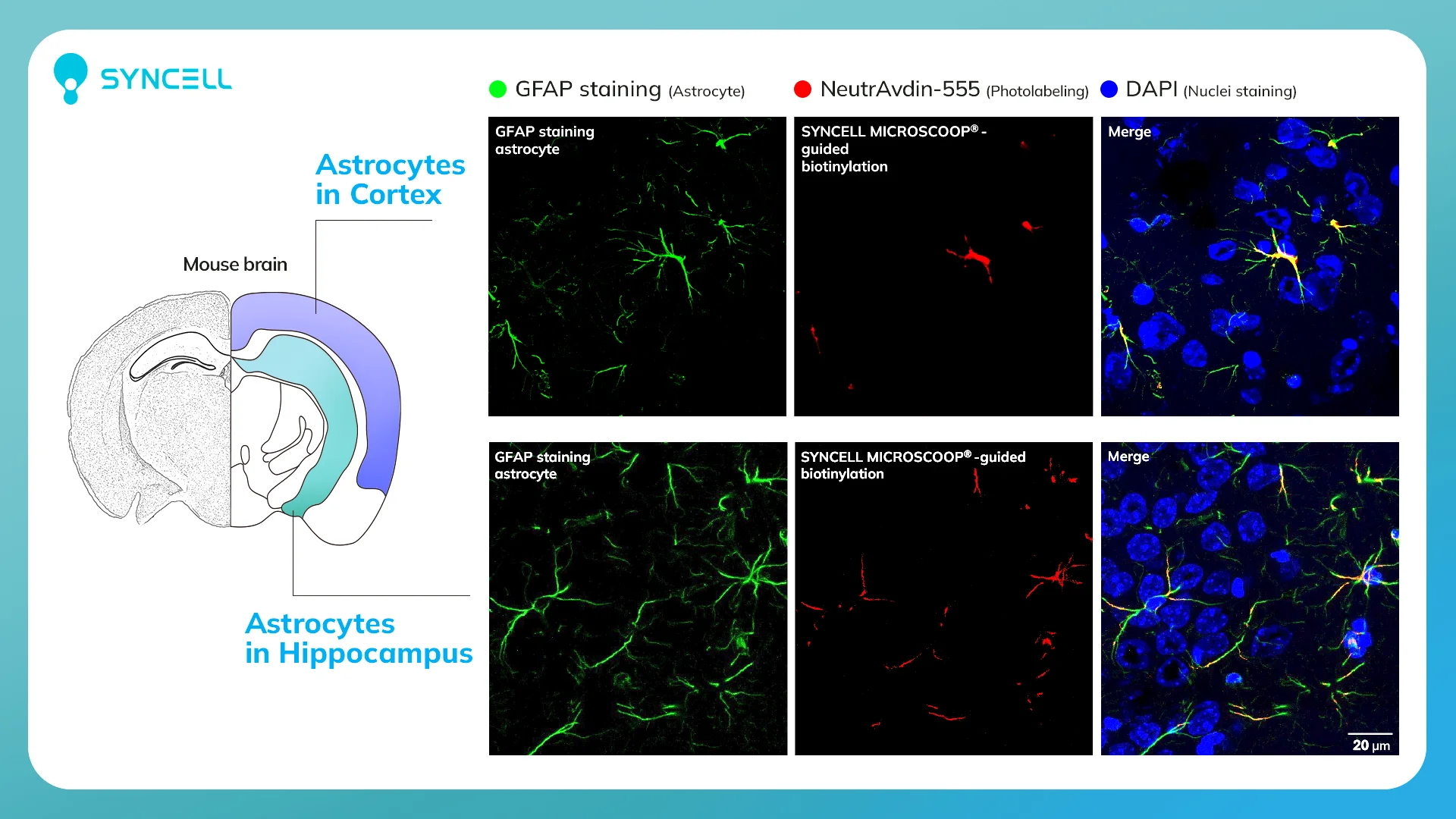 Datasets - Astrocyte | Syncell Inc