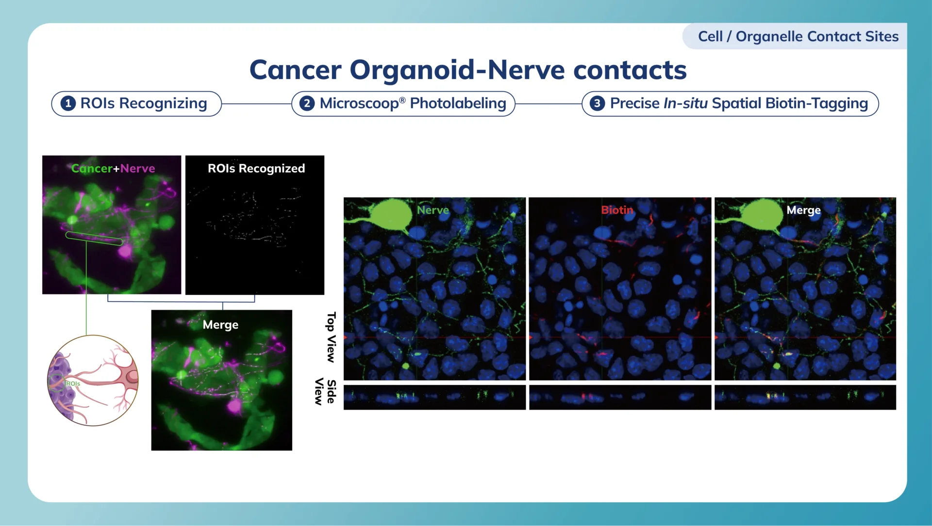 Datasets - Nerve Cancer Intersection | Syncell Inc
