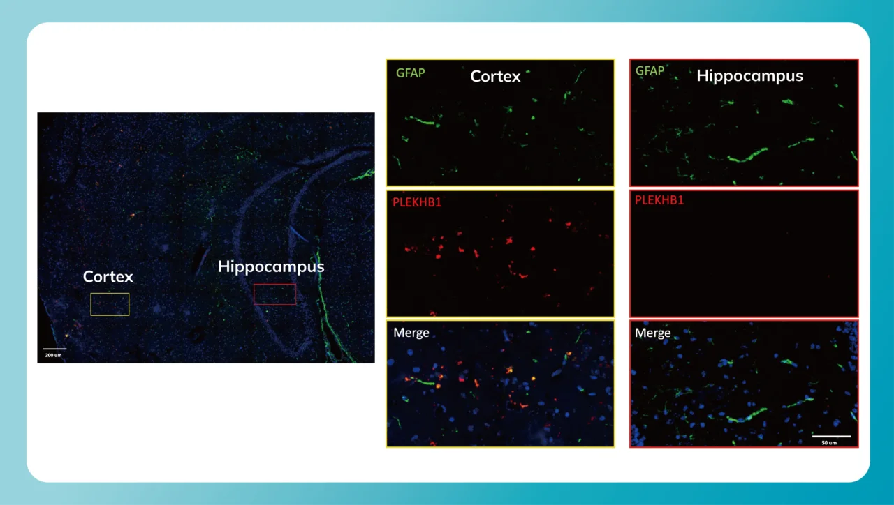 Datasets - Astrocyte | Syncell Inc