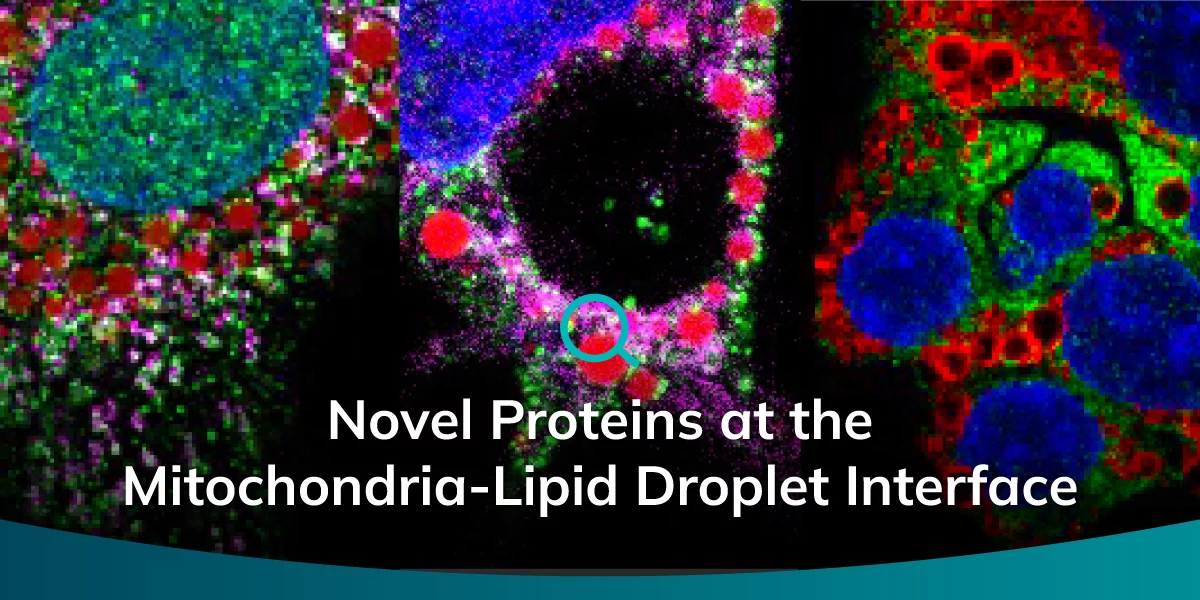 Microscopy-Guided Spatial Proteomics Reveals Novel Proteins at the Mitochondria-Lipid Droplet ...