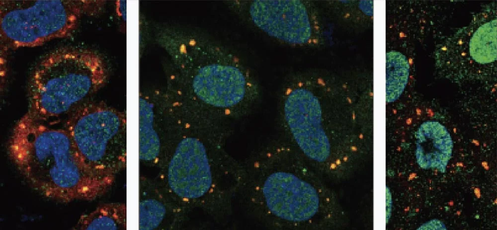 Proteomics in Cell Biology & Disease Mechanisms | Syncell
