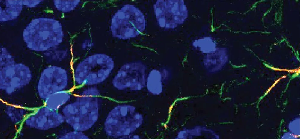 Proteomics in Cell Biology & Disease Mechanisms | Syncell