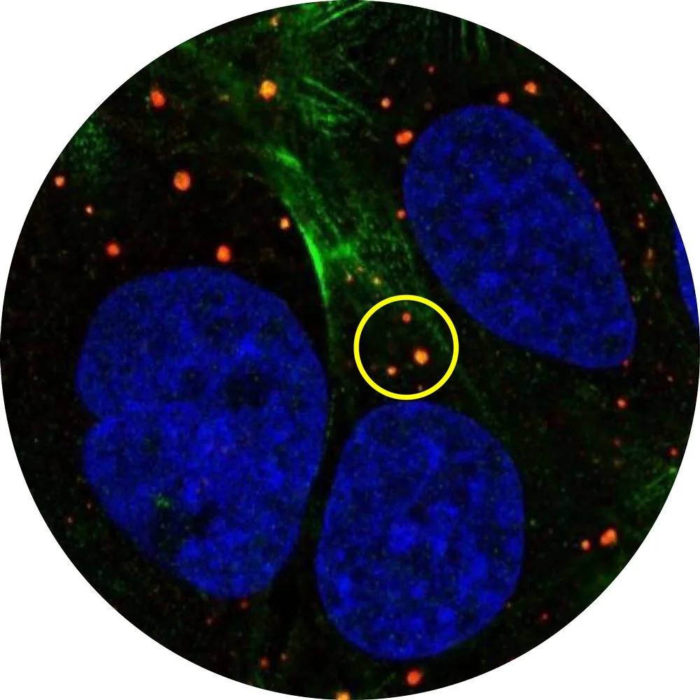 Proteomics in Cell Biology & Disease Mechanisms | Syncell